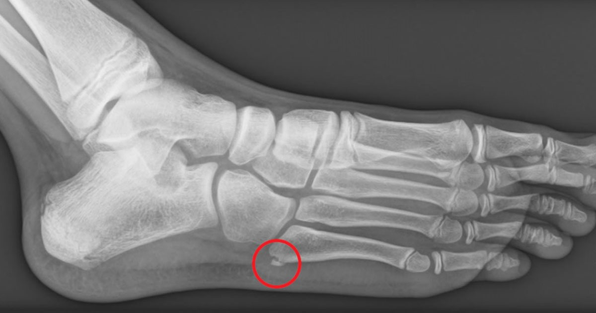 Melbourne Foot & Ankle Injury Clinic | Mr Daniel Goldbloom